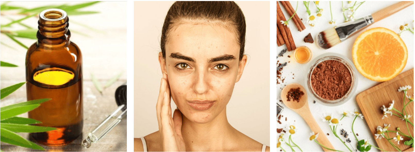 Get Rid of Acne Naturally With These 4 Ingredients – Beauty by Earth
